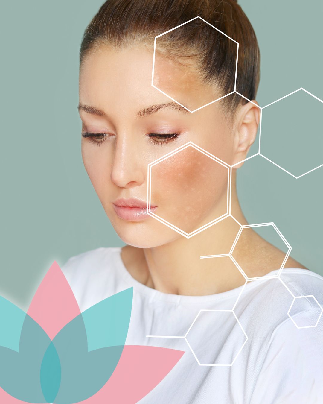 Lutter contre les tâches cutanées et les solutions pour les effacer